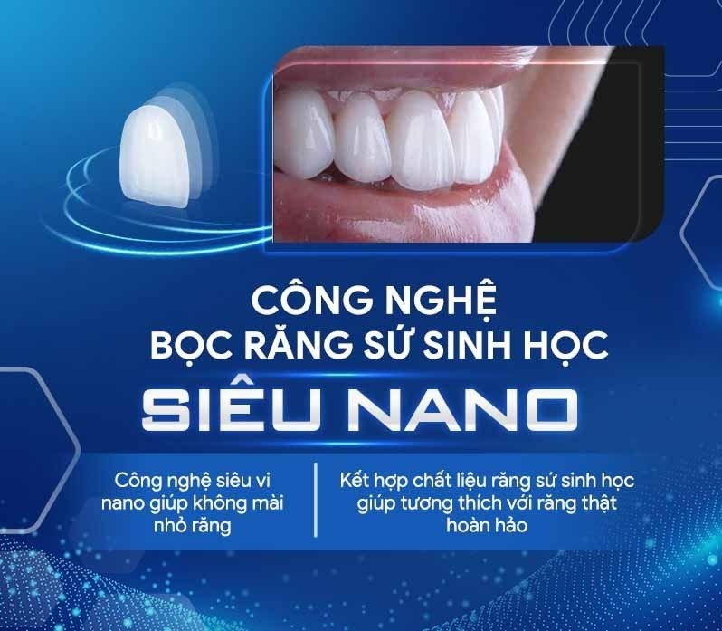 10+ Răng đẹp tự nhiên Từ góc nhìn chuyên gia