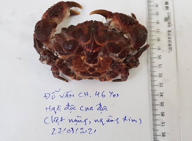 Thông tin mới nhất về sức khoẻ người đàn ông ăn phải cua độc