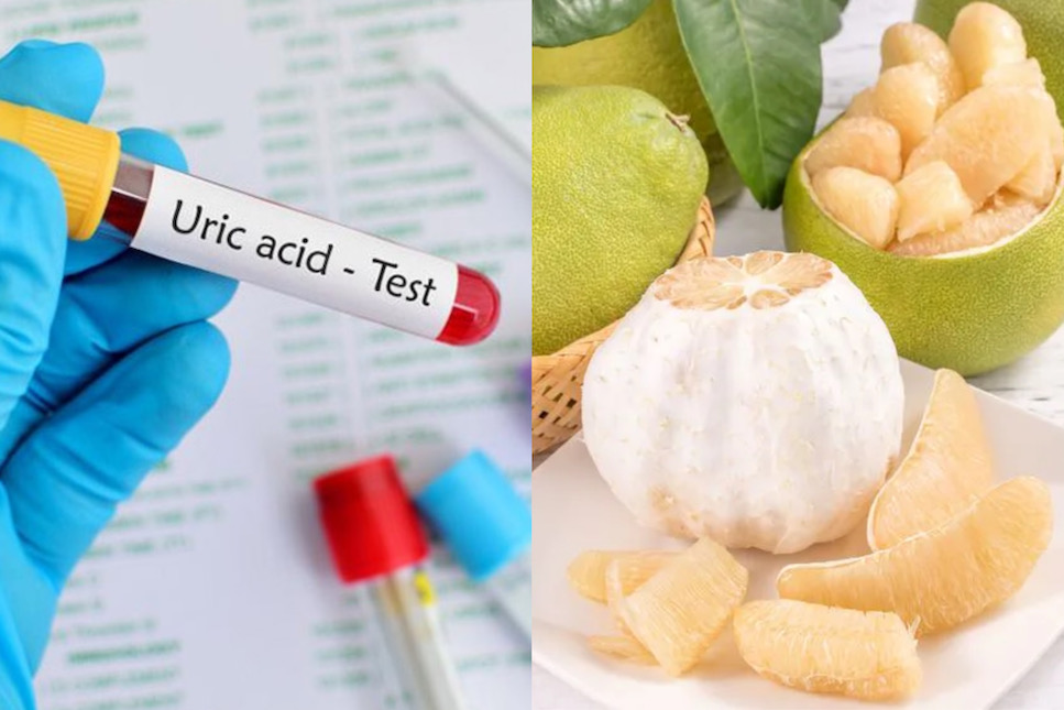 4 loại nước quen thuộc giúp giảm axit uric