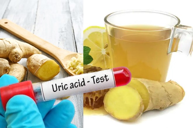 Những loại dầu có thể dùng hàng ngày giúp giảm axit uric hiệu quả