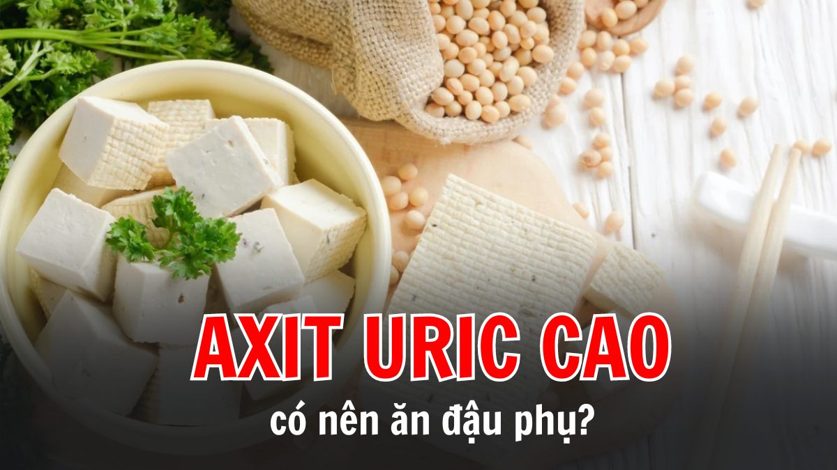 Người có axit uric cao nên tránh ăn 4 loại gia vị quen thuộc này
