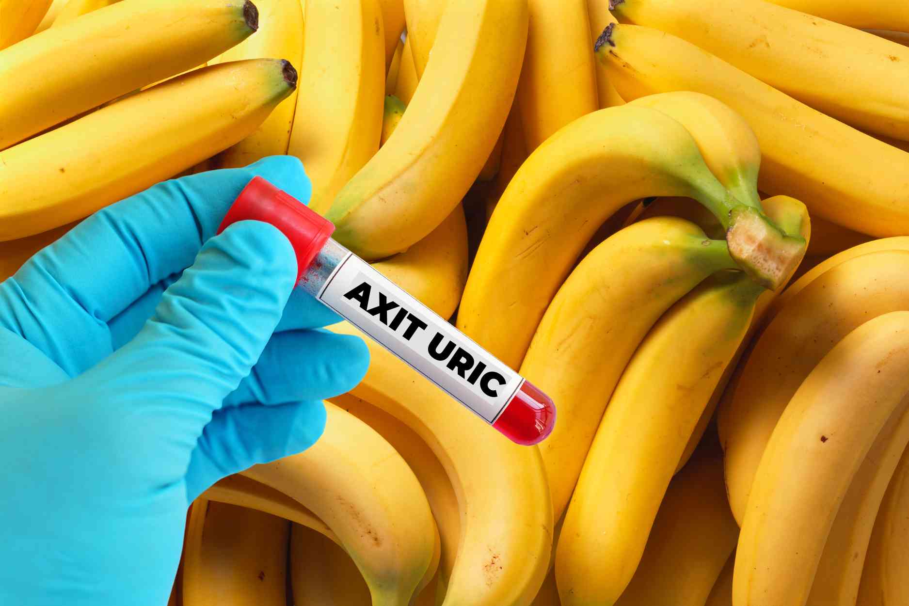 Ăn nhiều chuối có giúp giảm nồng độ axit uric trong máu?