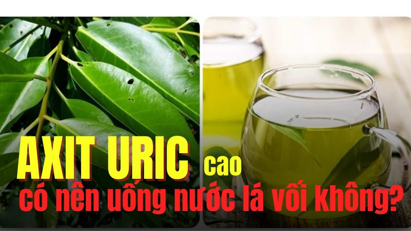 Axit uric cao và 8 cách để ngăn ngừa