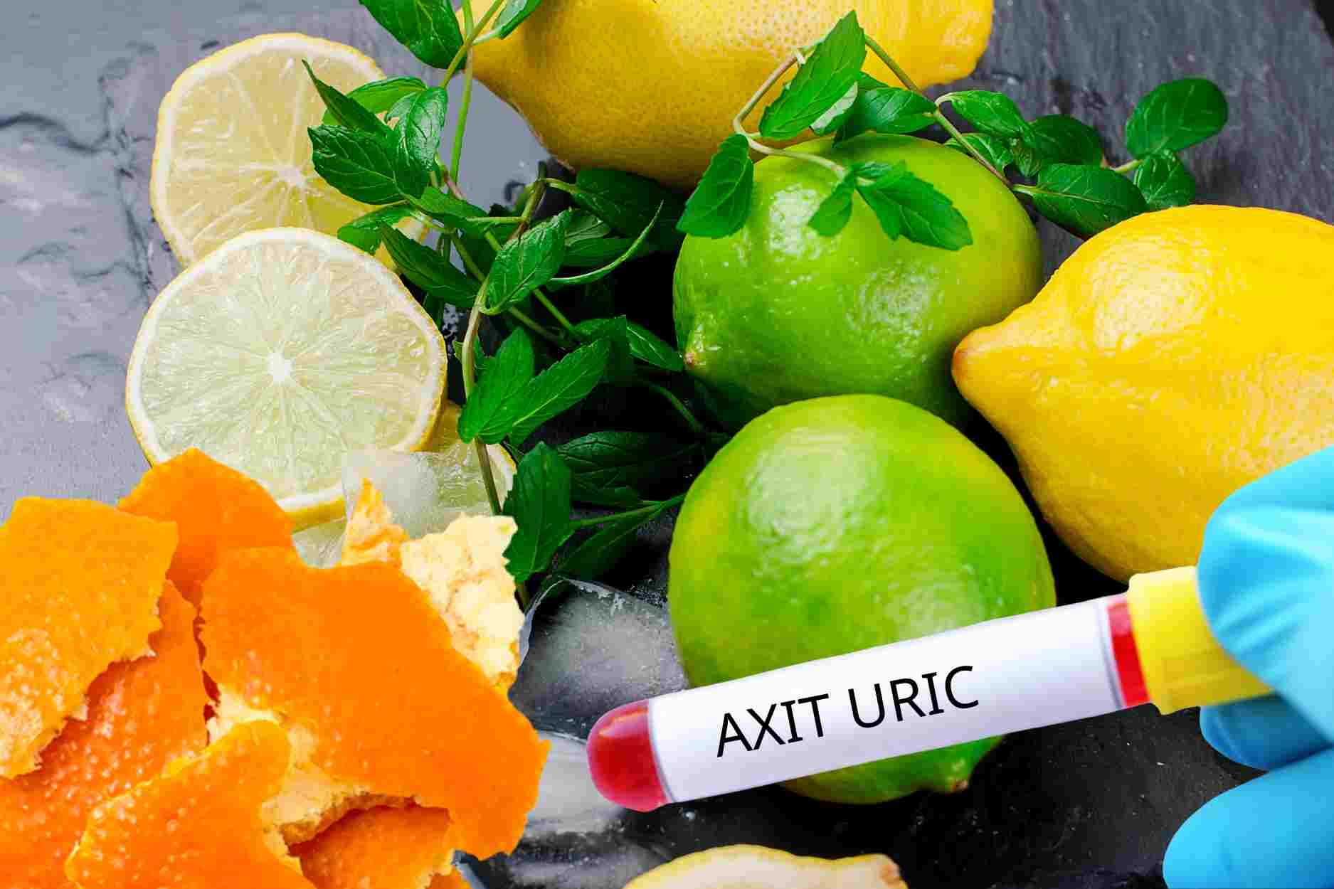 Nguyên nhân nào gây ra sự tăng đột biến nồng độ axit uric?