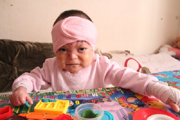 LD1745: Rớt nước mắt bé gái 5 tuổi mắc phải căn bệnh quái ác